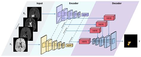 Review — Self Supervised Multi Modal Hybrid Fusion Network For Brain