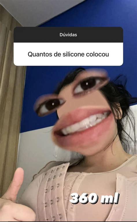 Aos 18 Anos Irmã De Mc Melody Faz Três Cirurgias Plásticas Veja Fotos