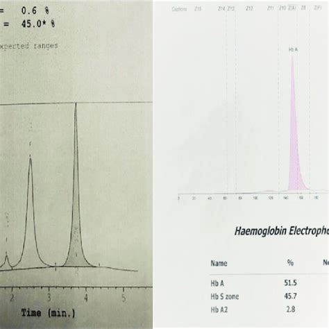 Genetic Analysis At 3500 Genetic Analyzer Thermo Scientific