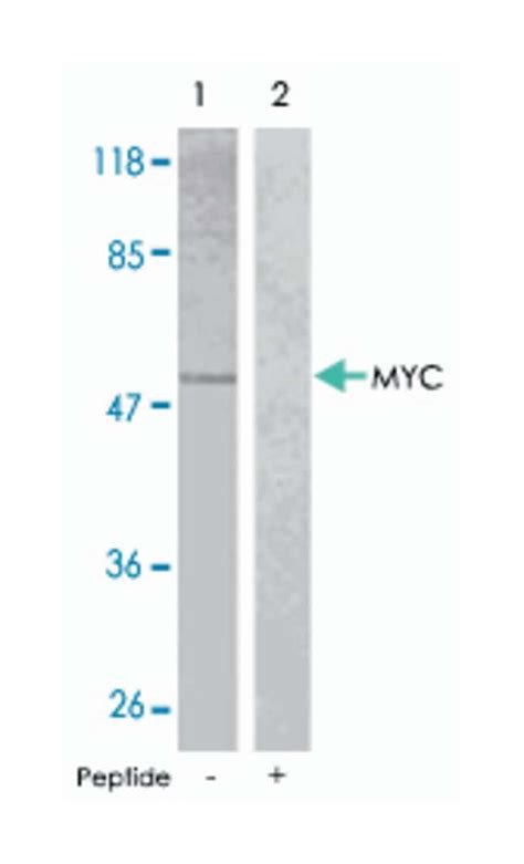 Anti Myc Antibody 100ug