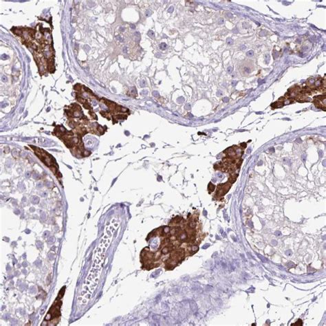 Rabbit Polyclonal Anti Cyp17a1 Antibody Buy For Research Highly Specific Rigorously