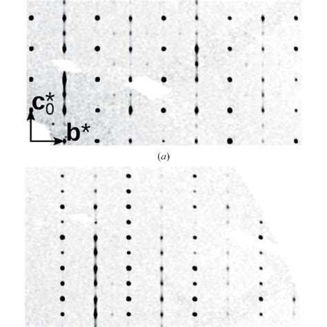 Sagittal View Of Computed Tomography Scan Demonstrates A Medial Condyle Download Scientific