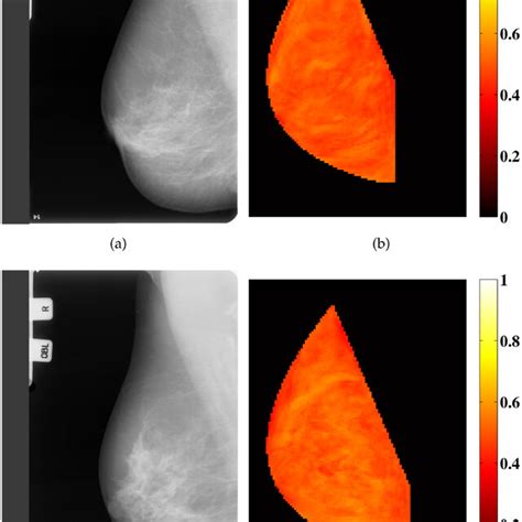 a and c a mammogram example from the control group b and d the