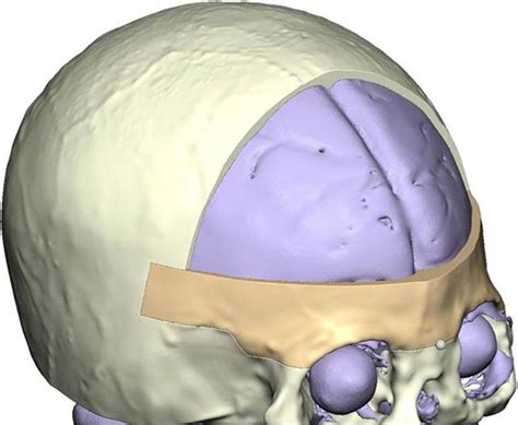 Virtual Segmentation Of The Skull Based On The Black Bone Dataset