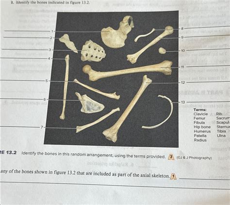 Solved Identify The Bones Indicated In Figure 13 2 RE Chegg Com