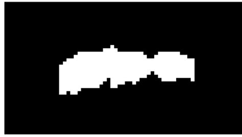 Binarized Image Of Mouth According Otsu Method Download Scientific Diagram