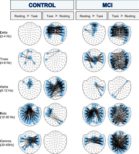 Statistical Differences In Connectivity Between Resting And