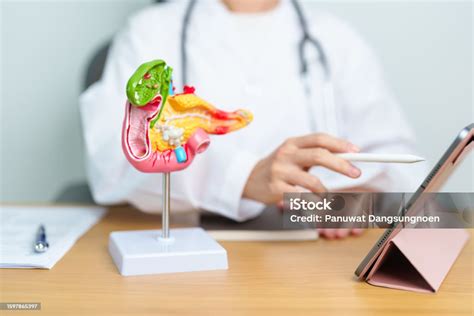 췌장 담낭 담관 십이지장 소장 및 정제가 있는 인간 췌장염 해부학 모델을 가진 의사 췌장암 급성 췌장염 및 소화기 계통 11월에 대한 스톡 사진 및 기타 이미지 Istock