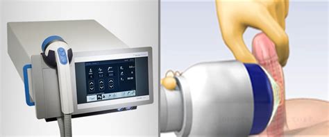 Effective Erectile Dysfunction Treatment Siam Clinic Thailand