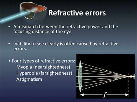 PPT Refractive Errors PowerPoint Presentation Free Download ID 9620885