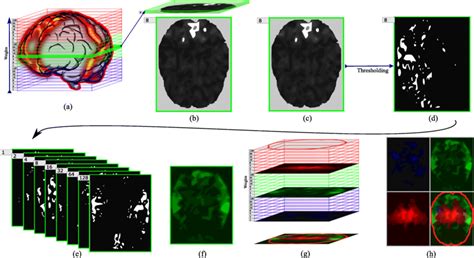 Volume Reduction Process In An Axial Rgb Image A Schematization Of The