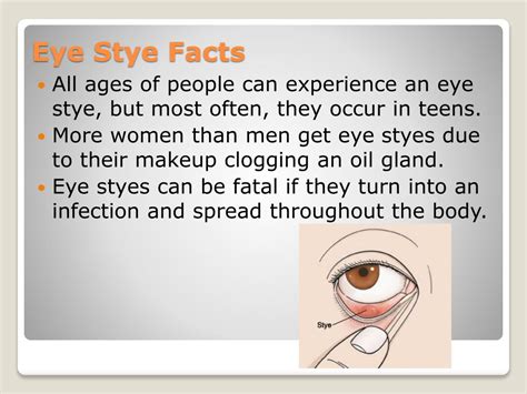 PPT Eye Stye PowerPoint Presentation Free Download ID