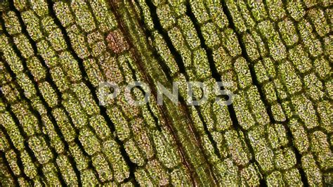 Elodea Cells Under A Microscope