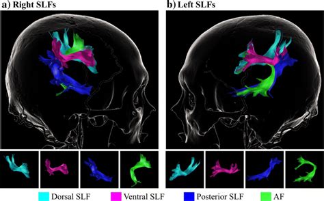 Superior Longitudinal Fasciculus Dti