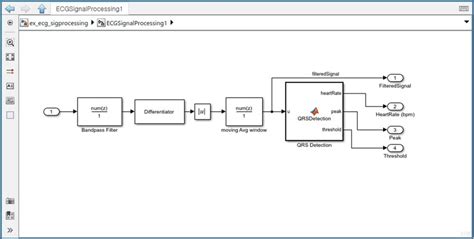 Detailed Ecg Signal Processing Block Download Scientific Diagram