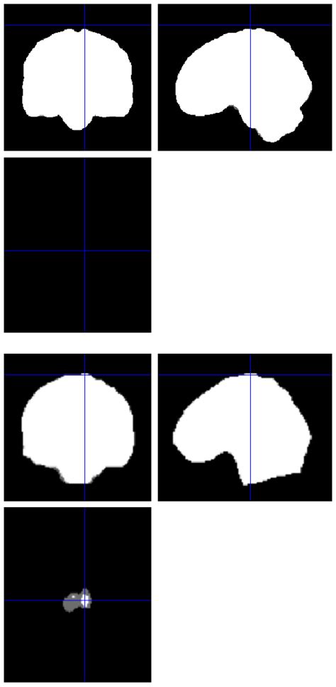 i used the t1w anatomical mask from fmriprep as an explicit mask for a