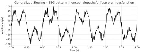 Electroencephalography Eeg Interpretation And Clinical Use The Anesthesia Guide
