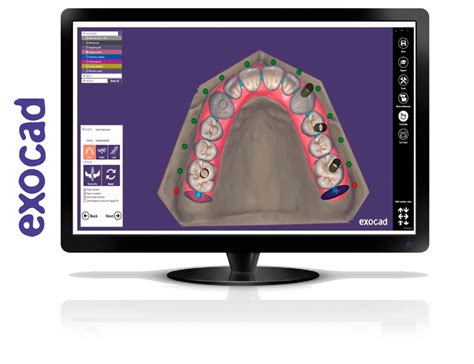 Download Exocad Library Ziacom Online