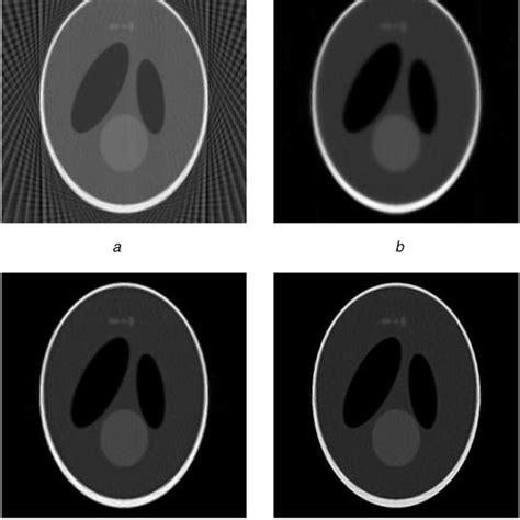 Reconstructed Volume For The Head Phantom A Fdk B Cgls C Sart Download Scientific