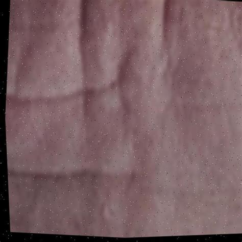 Skin Deseas Object Detection Model By Muhammad Rifqi Maruf