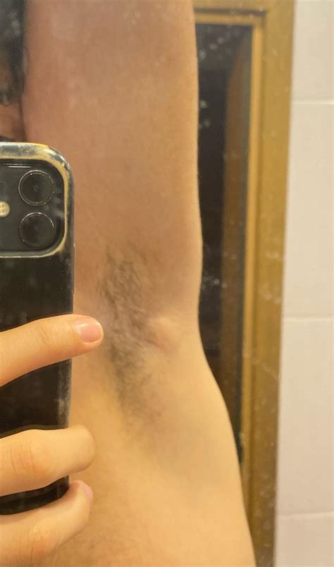 Is That A Swollen Lymph Node Rmedical