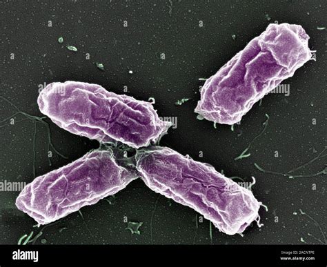 Salmonella Bacteria Coloured Scanning Electron Micrograph Sem Of