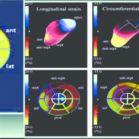 Normal Strain And Strain Rate Patterns In Different Segments Download