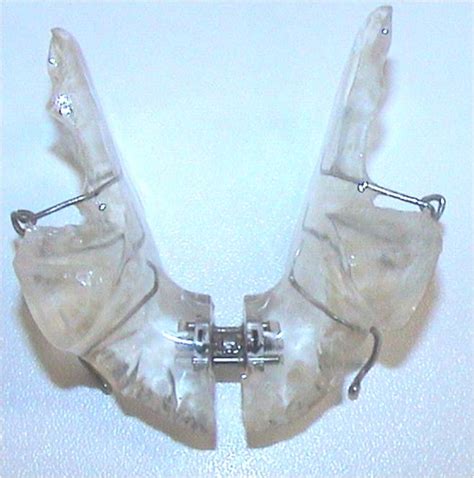 Twin Block Invisalign® Prof Dr Polzar Kku