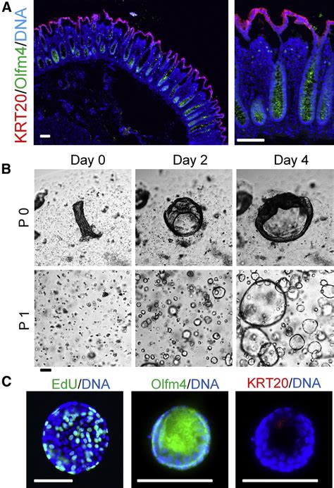 Organoid Culture Of Human Colonic Epithelial Cells A Download