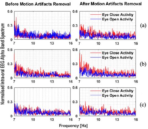Figure 1 From A Sensor Fusion Method For Motion Artifacts Reduction In