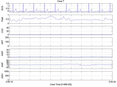 Case 7 Waveform Plots 10 Second Plots Case 7 Waveform Plots 10 Second Plots