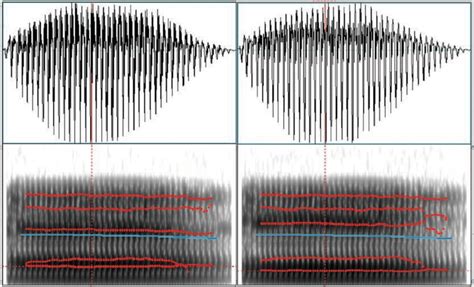The Waveforms And Spectrograms Of The Standard [ε] Left And Deviant