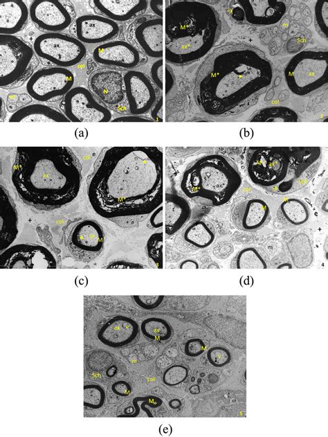 Representative Electron Micrographs Of The Sciatic Nerve In The A