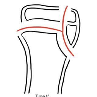 Ryu Debenham Addition Download Scientific Diagram