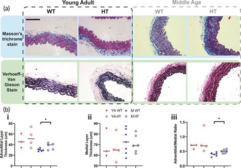 Hif2a Ht Middle Age Female Mice Exhibit A Thicker Adventitial Layer Download Scientific Diagram