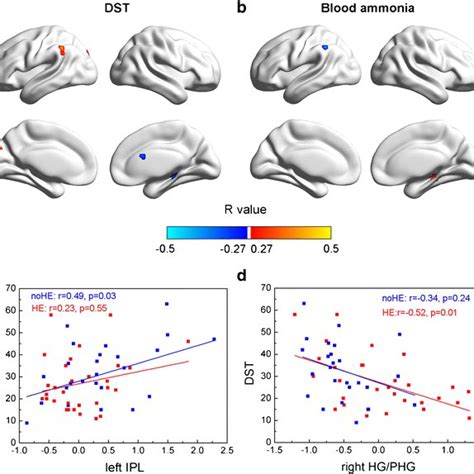 Correlation Of Functional Connectivity Density Fcd With Digit Symbol