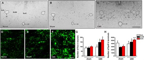 Immunostaining Results Showing The Expression Of Fos Ir Neurons And