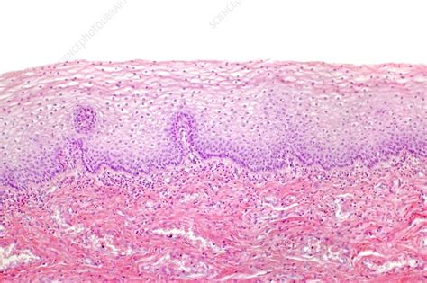 Vagina Light Micrograph Stock Image C Science Photo My XXX Hot Girl