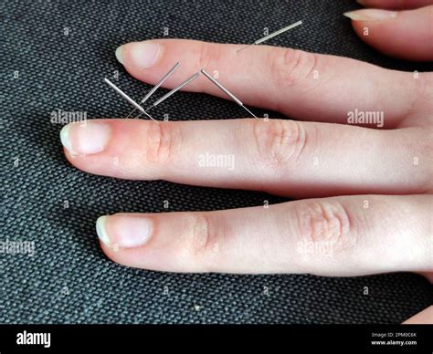 Pins And Needles In Little Finger At Colby Westlake Blog