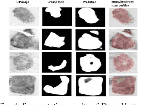 Figure 4 From U Net Based Deep Learning Architectures For Latent Fingerprint Segmentation