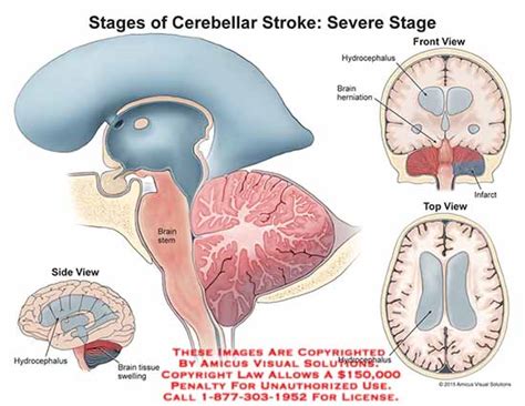 Medical Exhibits Demonstrative Aids Illustrations And Models