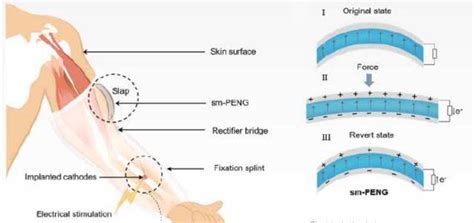 Schematic Diagram Of Self Powered Electrical Stimulation For Bone Download Scientific Diagram