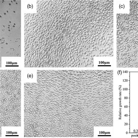 The Morphology Of Porous Titanium After Different Methods A Download Scientific Diagram
