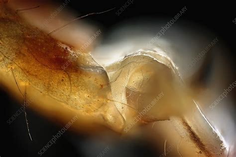 Locust Leg Light Micrograph Stock Image C026 4182 Science Photo Library