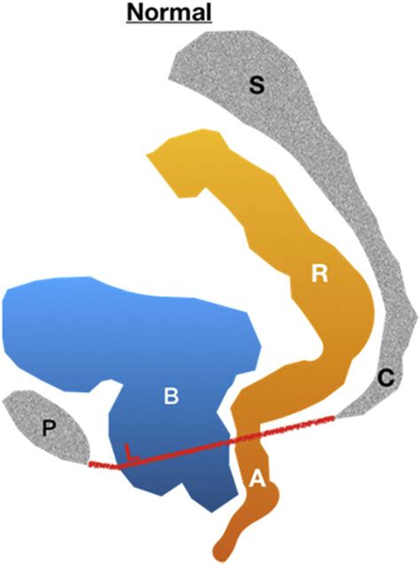 Sagittal Schematic Normal Alignment Of The Pelvic Floor Pubococcygeal Download Scientific