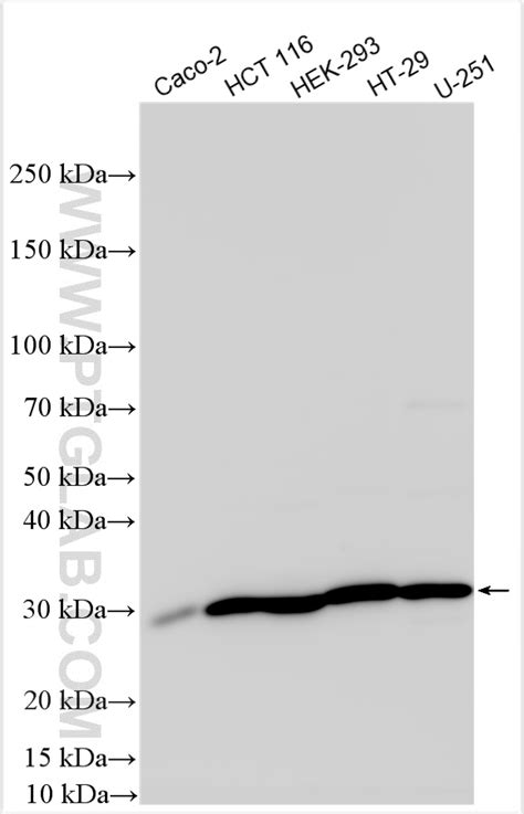 Hsd17b12 Antibody 27461 1 Ap Proteintech 武汉三鹰生物技术有限公司