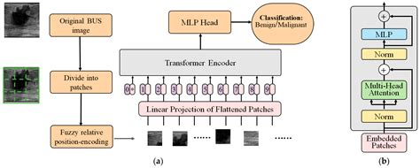 A Novel Fuzzy Relative Position Coding Transformer For Breast Cancer