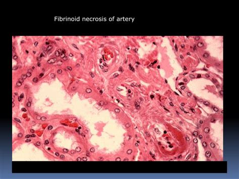 Ppt Necrosis And Apoptosis Powerpoint Presentation Free Download
