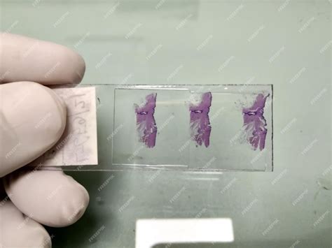 Premium Photo Stained Histology Slide Which Is Ready For Microscopic