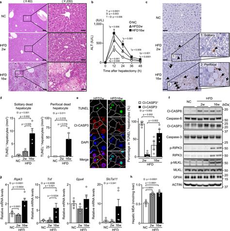 Non Apoptotic Cell Death Is Increased In Severe Steatosis After Download Scientific Diagram
